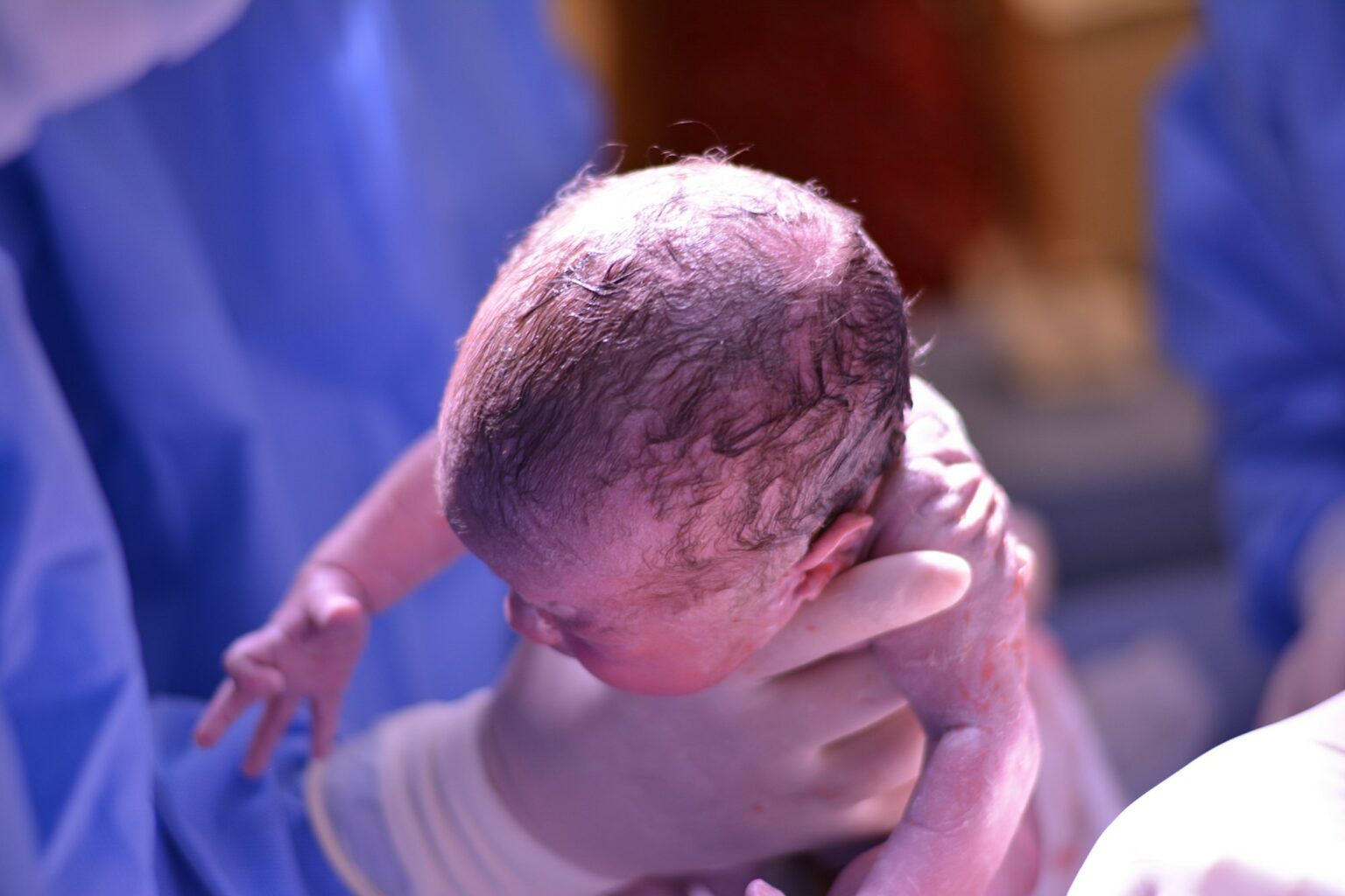 Emergency cesarean: key facts, risks, recovery & parent guide